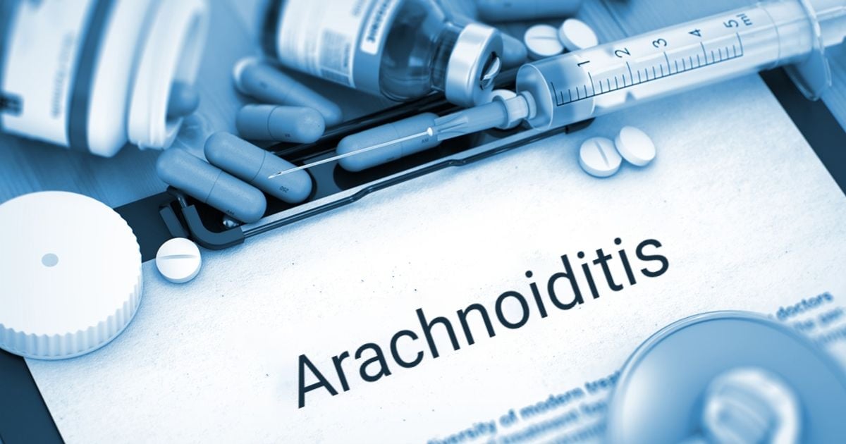 Causes, Symptoms, and Treatment Options for Arachnoiditis - Facty Health