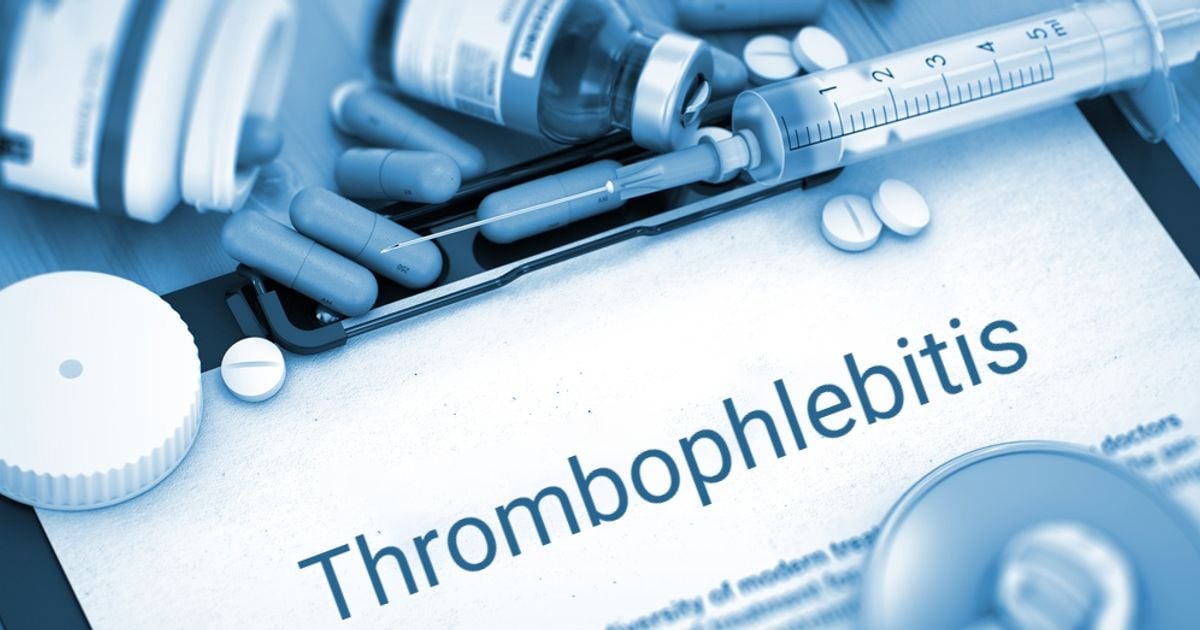 Causes, Signs, and Treatments of Thrombophlebitis - Facty Health