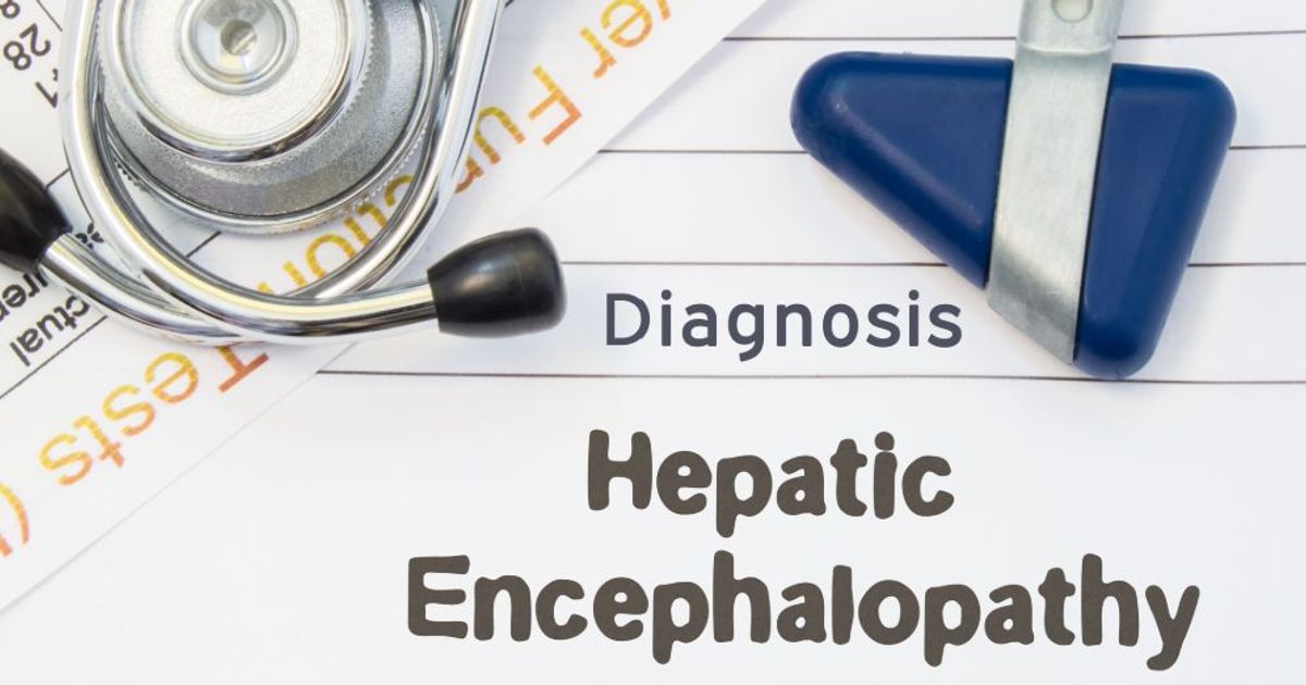 Advanced Liver Disease Leads to Hepatic Encephalopathy - Facty Health