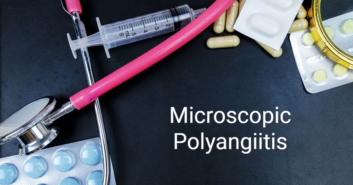 Blood Vessel Inflammation and Microscopic Polyangiitis - Facty Health