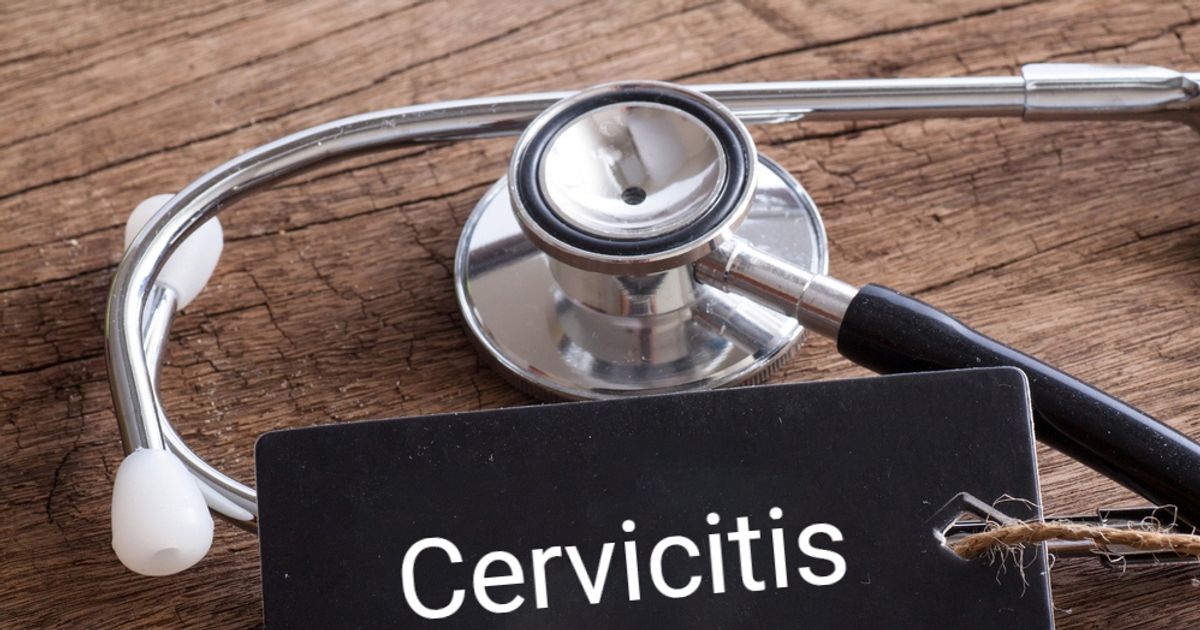 Facts About Cervicitis That Every Woman Should Know - Facty Health
