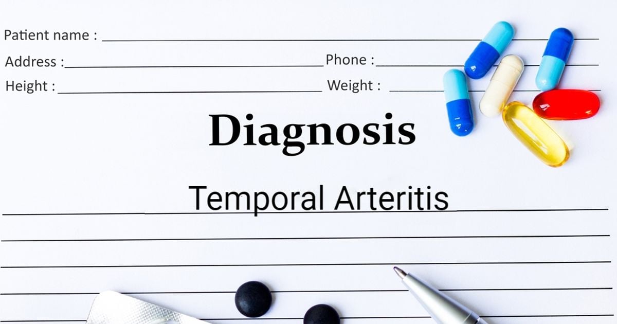 Temporal Arteritis Is More Serious Than a Simple Headache - Facty Health