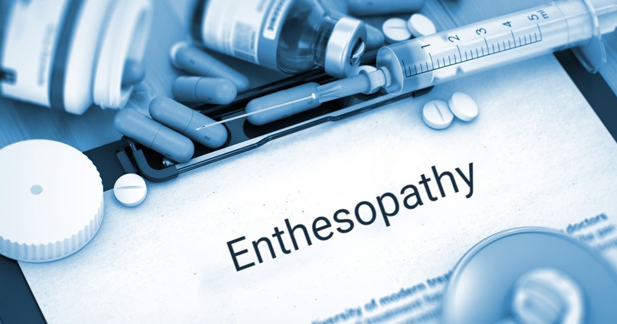 Enthesopathy Causes Tendon or Ligament Pain - Facty Health