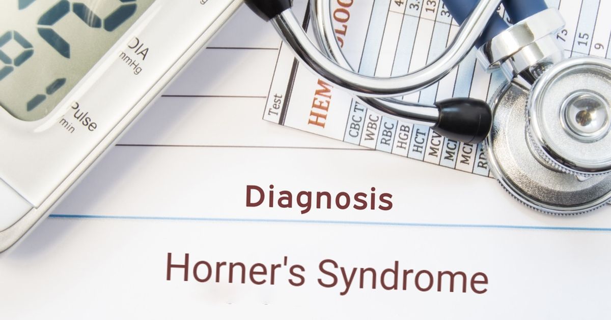 What Is Horner's Syndrome? - Facty Health