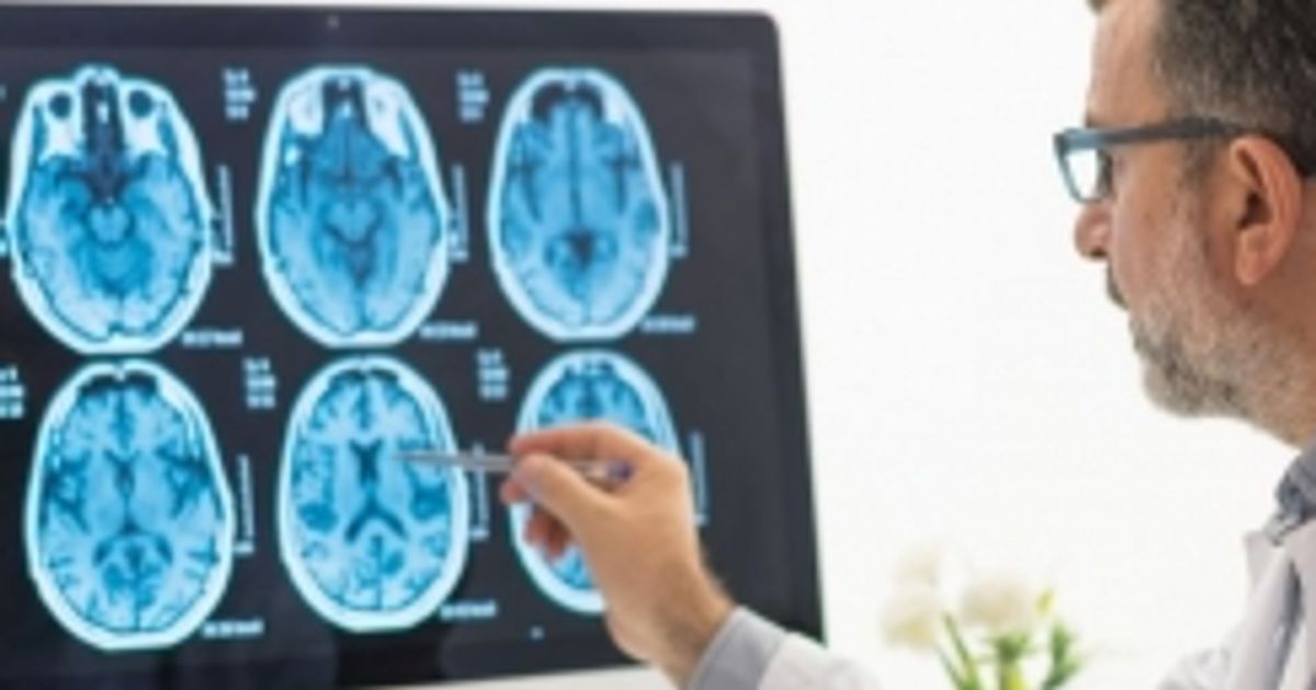 Cancers of the Central Nervous System - Facty Health