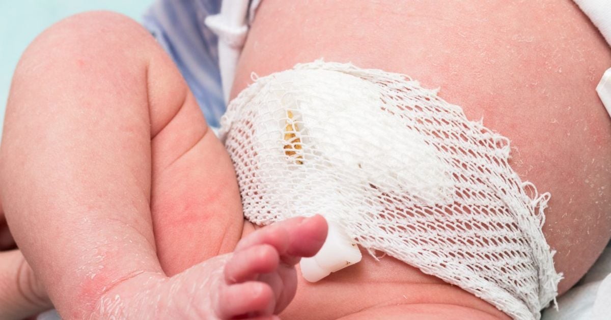 Belly Button Infections In Infants - Facty Health