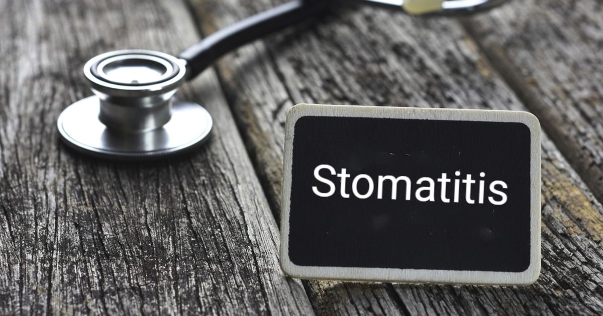 Types of Stomatitis and What to Do - Facty Health
