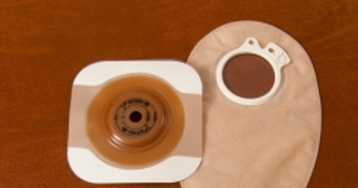 Types Of Ileostomy Procedures And Possible Risks Facty Health