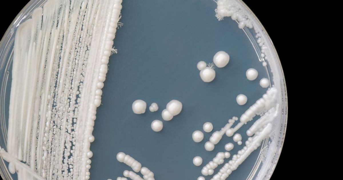 Cutaneous Candidiasis Skin Infection - Facty Health