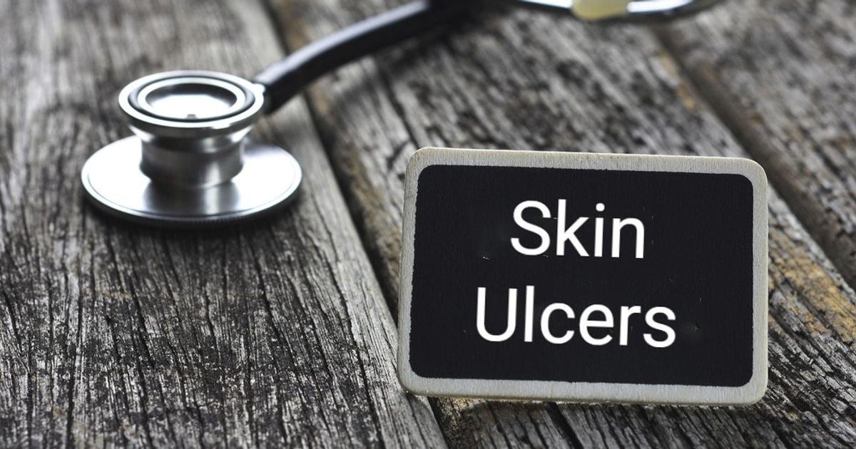 Identifying and Dealing with Skin Ulcers - Facty Health