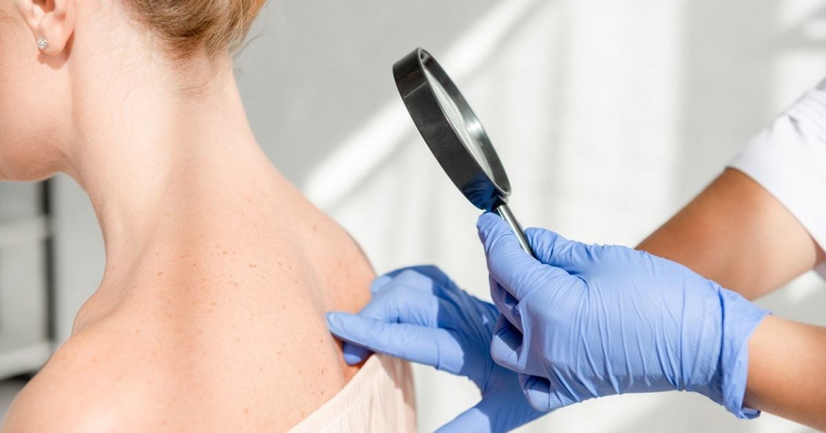 Skin Lesions and Their Diagnosis - Facty Health