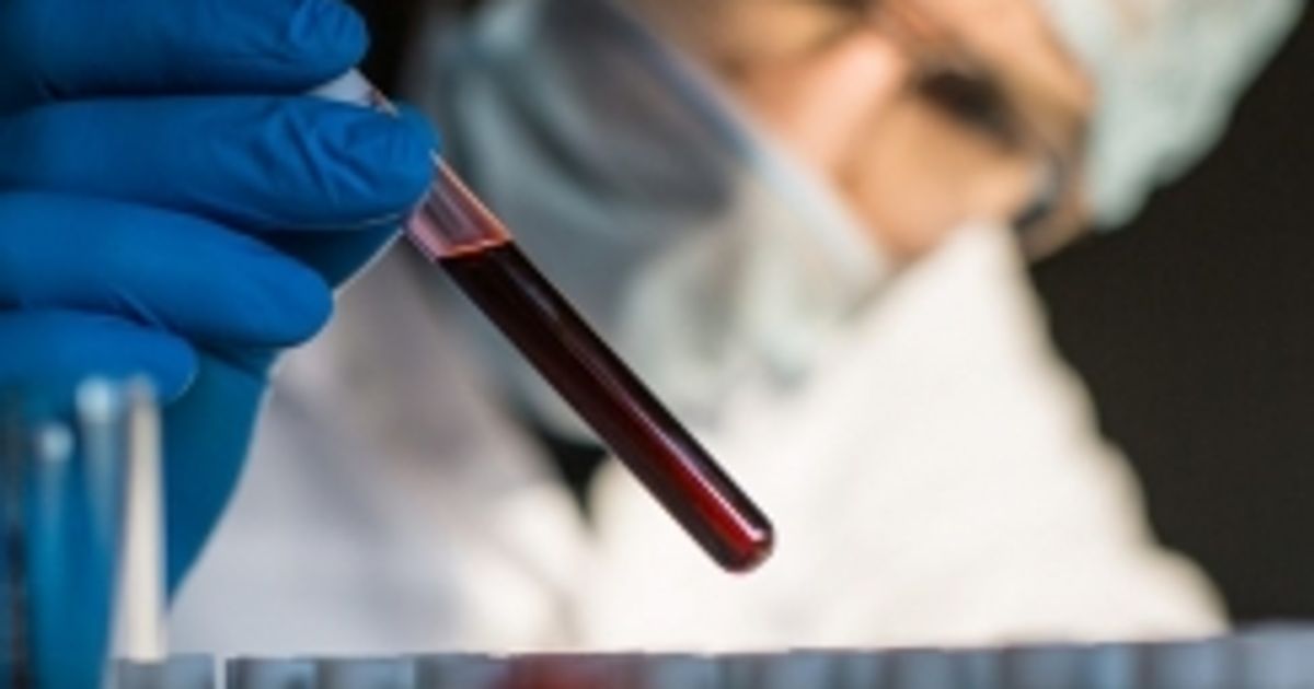 Hematology: Studying and Diagnosing Blood Disorders - Facty Health