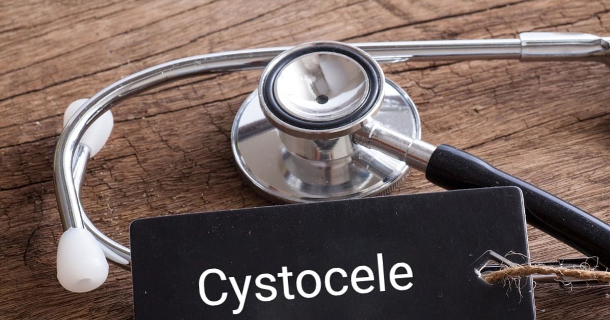 Understanding Cystocele: Causes, Symptoms, and Treatments - Facty Health