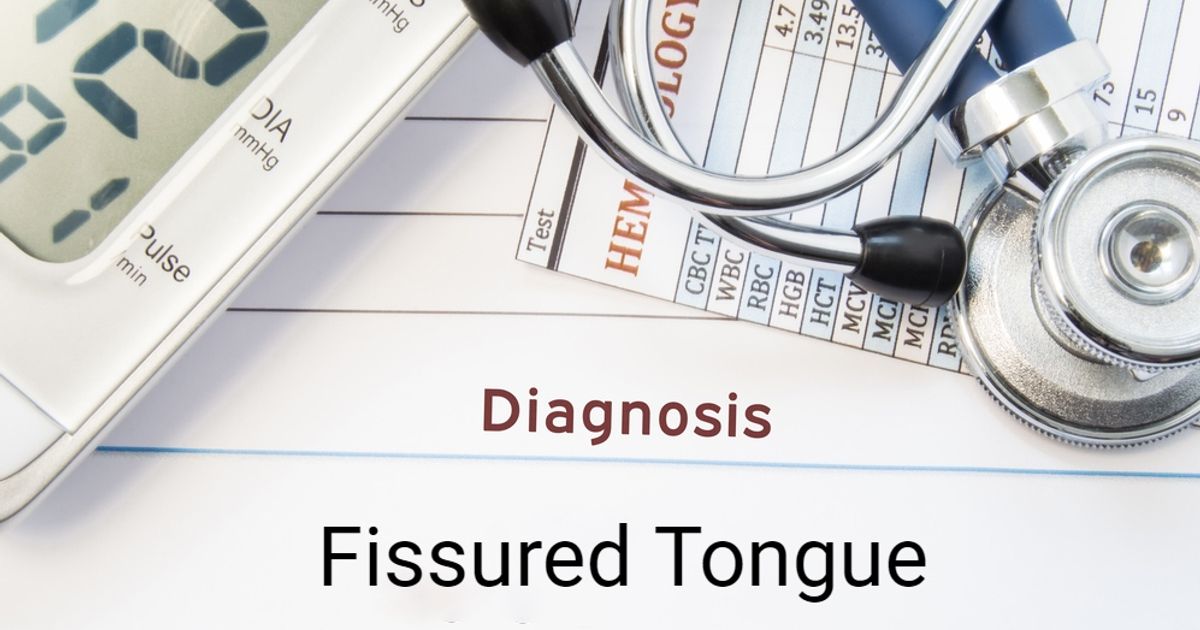 Causes, Effects, and Signs of Fissured Tongue - Facty Health