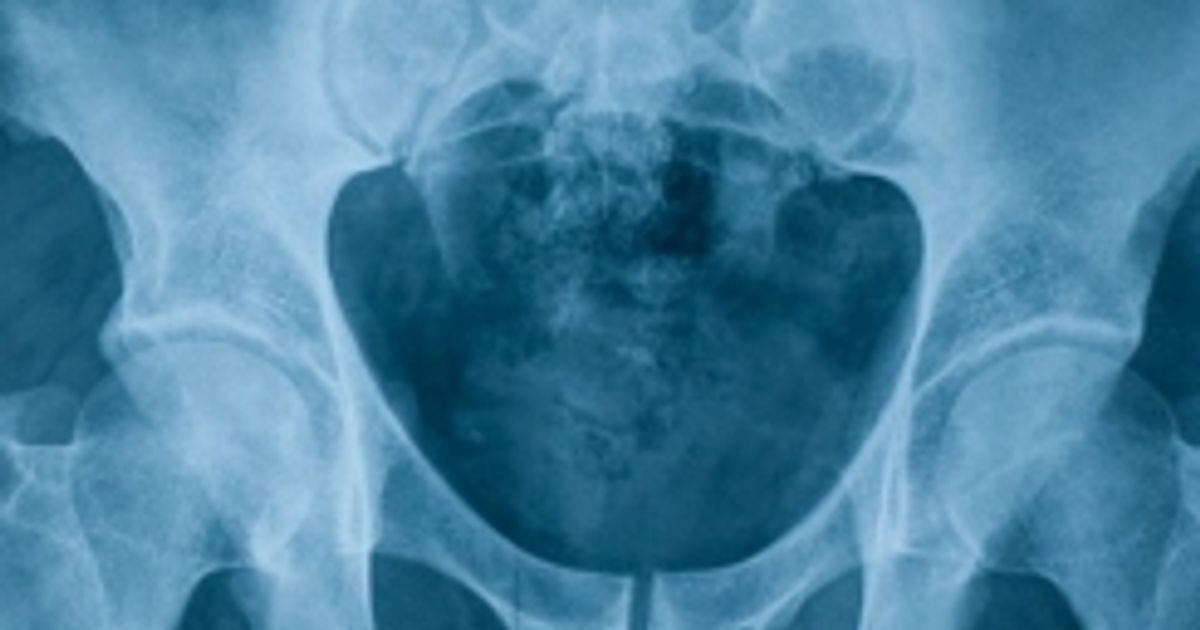 The Anatomy of the Perineum and Related Conditions - Facty Health