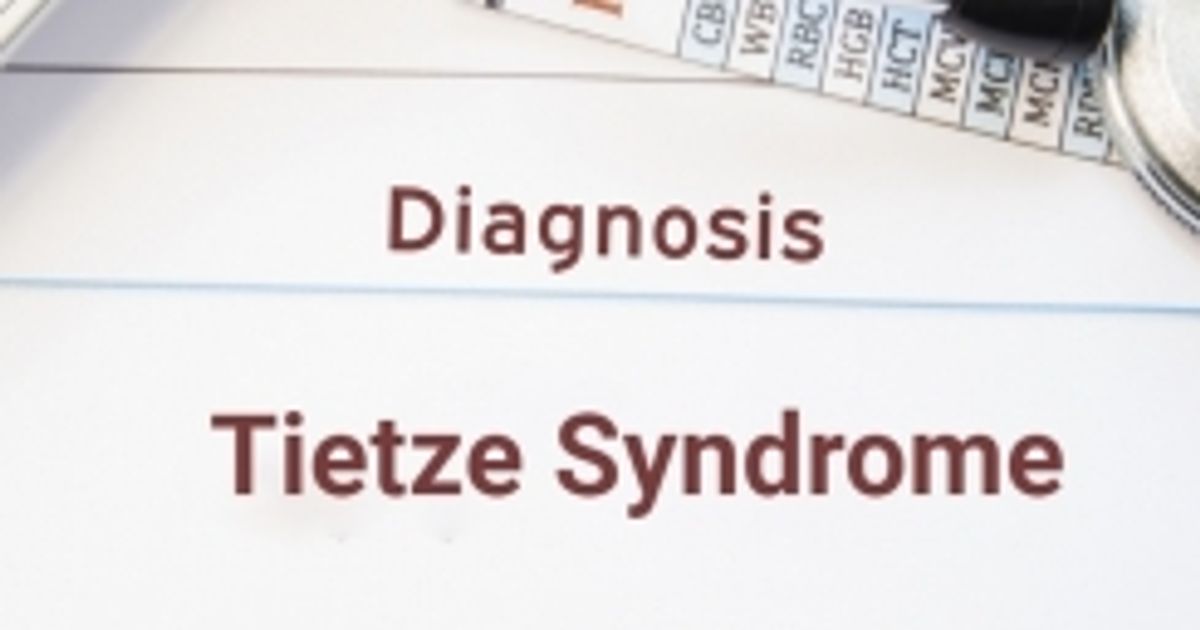 Tietze Syndrome: A Rare Inflammatory Disorder - Facty Health