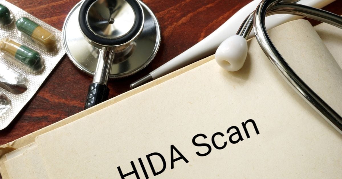 HIDA Scans: A Step-by-Step Overview - Facty Health