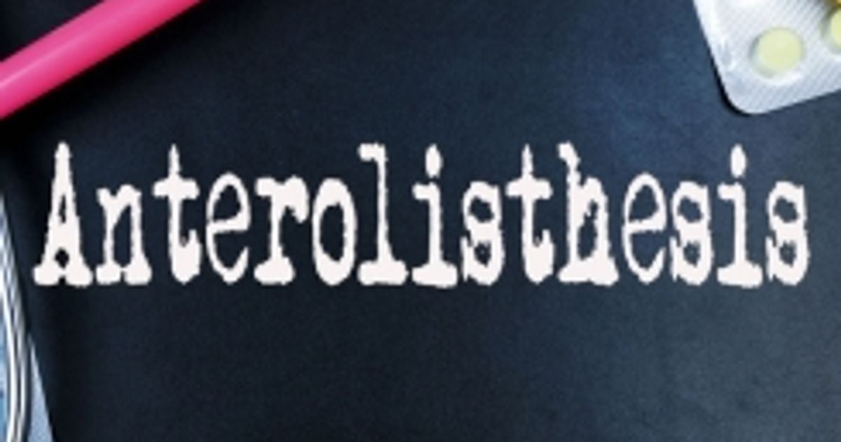 What is Anterolisthesis? - Facty Health