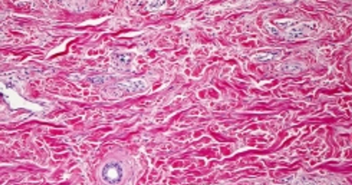 How the Dermis Impacts Overall Health - Facty Health