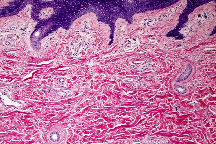 How the Dermis Impacts Overall Health - Facty Health