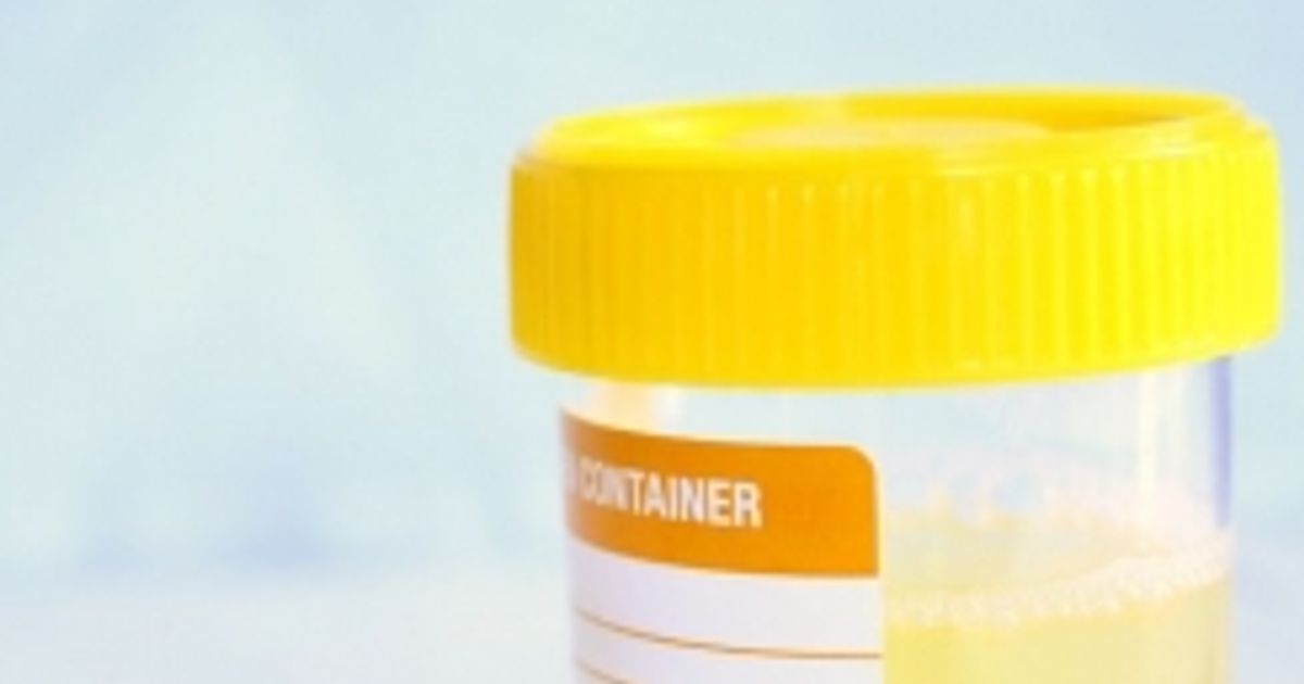 Causes, Symptoms, and Treatments of Cloudy Urine - Facty Health