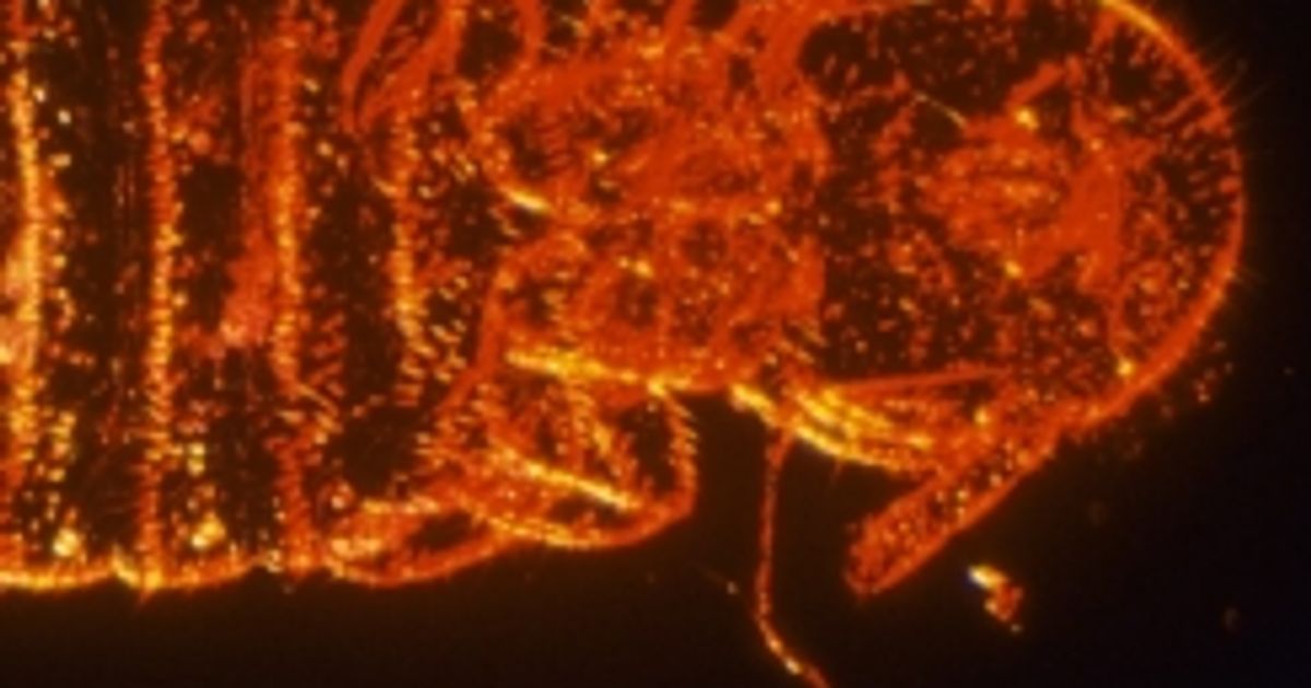Body Lice: Symptoms, Causes, Treatment, and Prevention - Facty Health