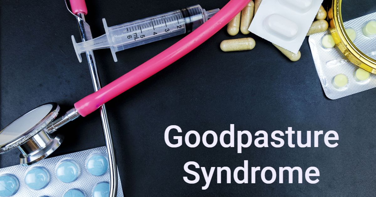 Goodpasture Syndrome: a Rare, Acute Illness - Facty Health