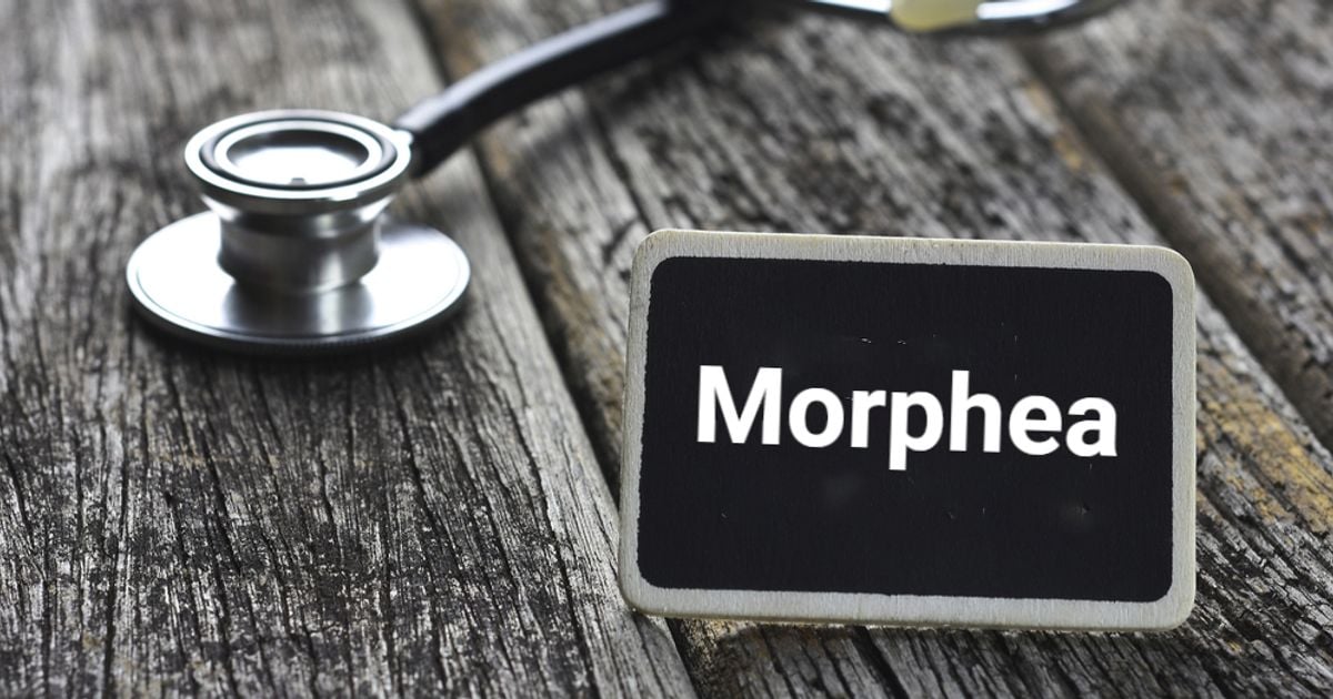 Signs, Causes, and Treatments of Morphea - Facty Health