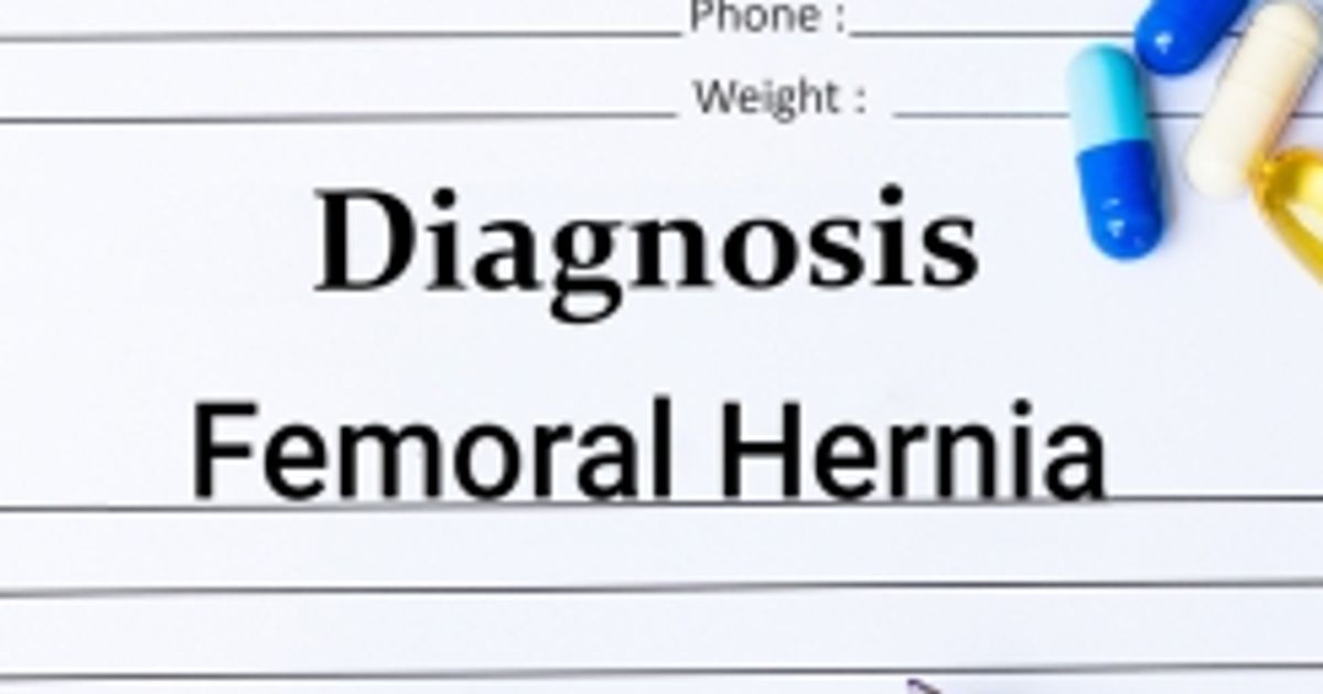 Femoral Hernia Anatomy, Causes, and Symptoms - Facty Health