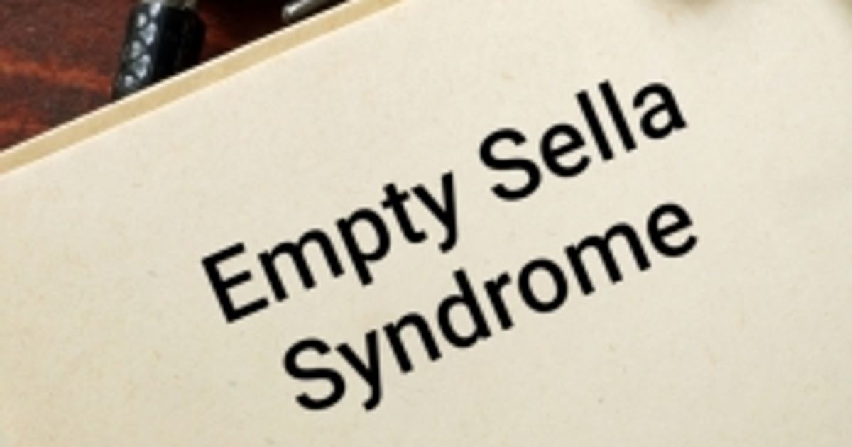 Empty Sella Syndrome and Pituitary Function - Facty Health