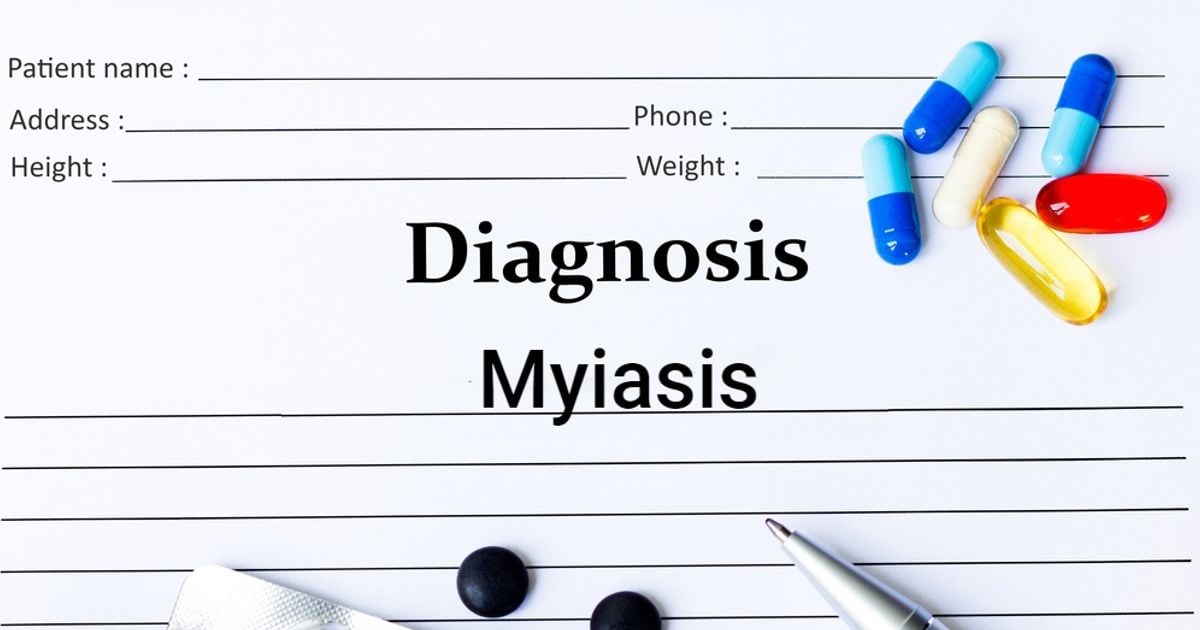 Recognizing and Treating Myiasis - Facty Health