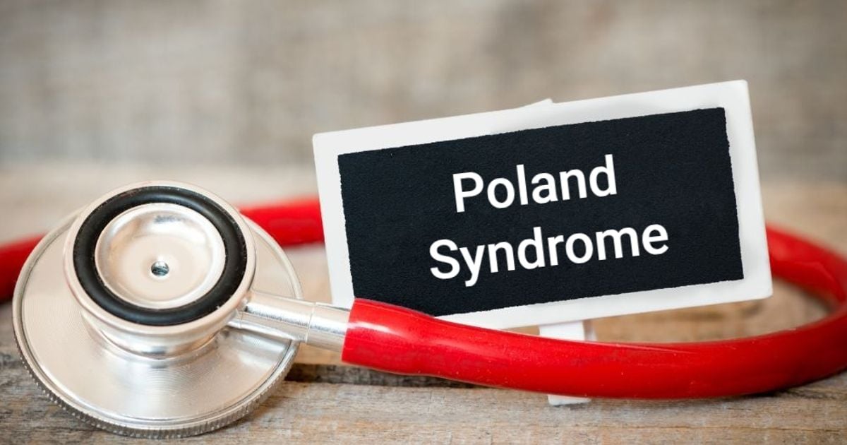 Causes, Signs, and Treatment of Poland Syndrome - Facty Health