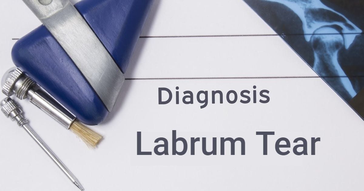 Labrum Tears of the Shoulder and Hip - Facty Health