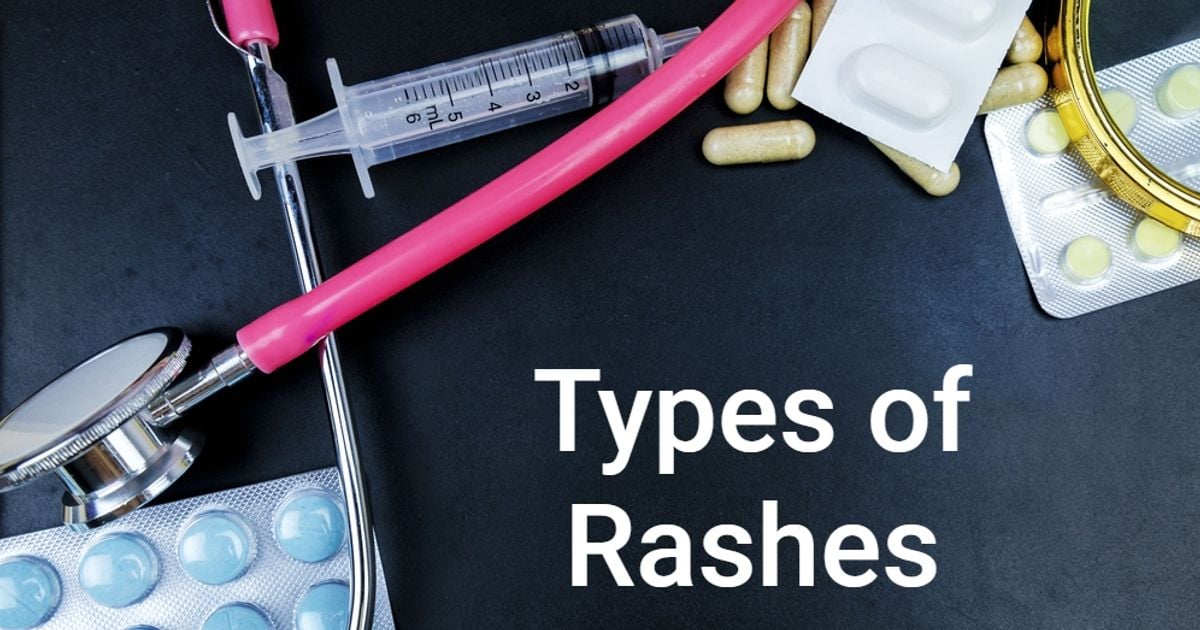 The Most Common Rashes That Affect the Skin - Facty Health