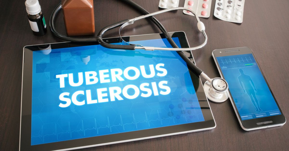 Tuberous Sclerosis: A Difficult Diagnosis - Facty Health