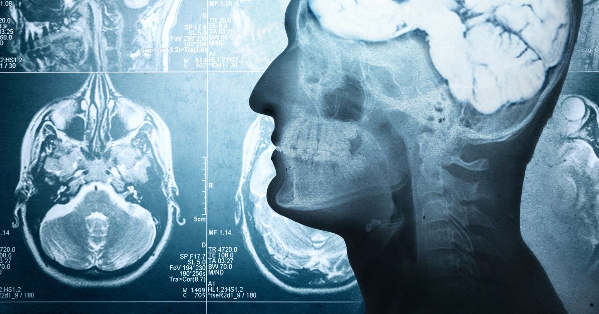 25 Amazing Facts About Your Brain - Facty Health