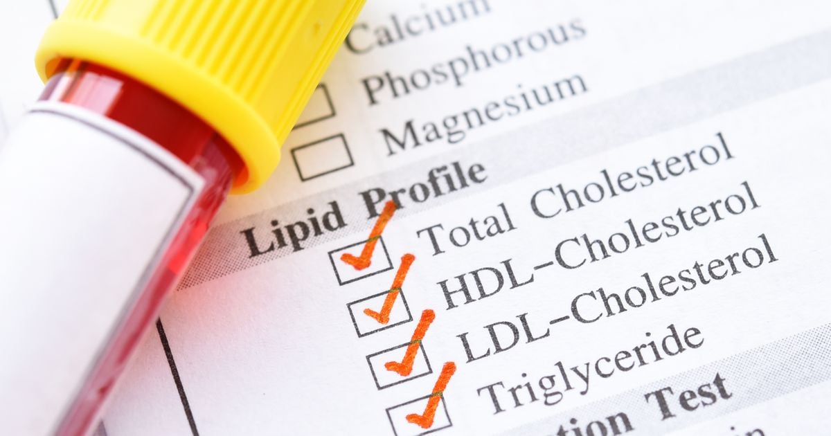 Everything You Wondered About Lipids - Facty Health