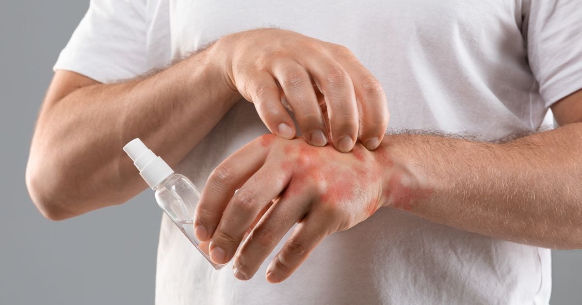 Ten Types of Infectious Fungi - Facty Health