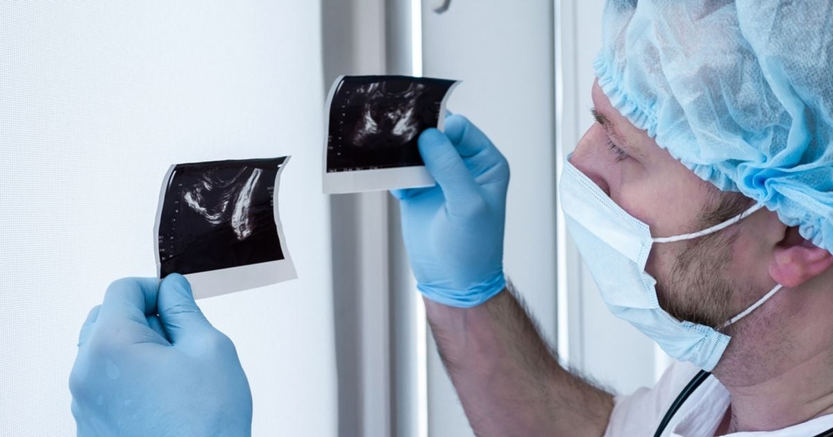 Adenomas: Everything you need to know - Facty Health