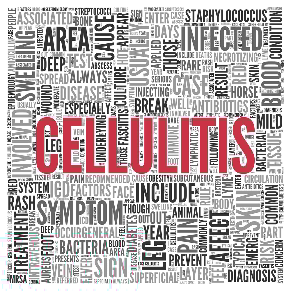 Treatments for Cellulitis - Facty Health
