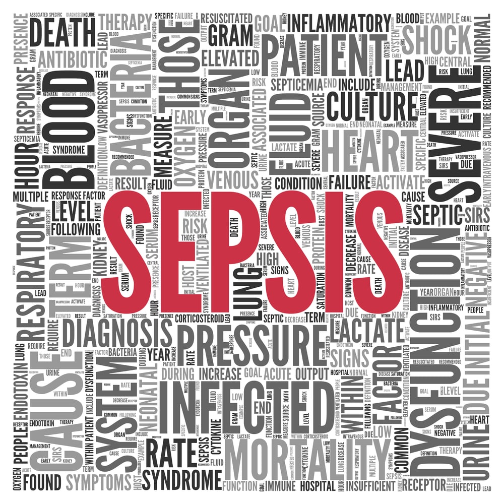 Spotting Sepsis: A Guide to Its Ten Symptoms - Facty Health