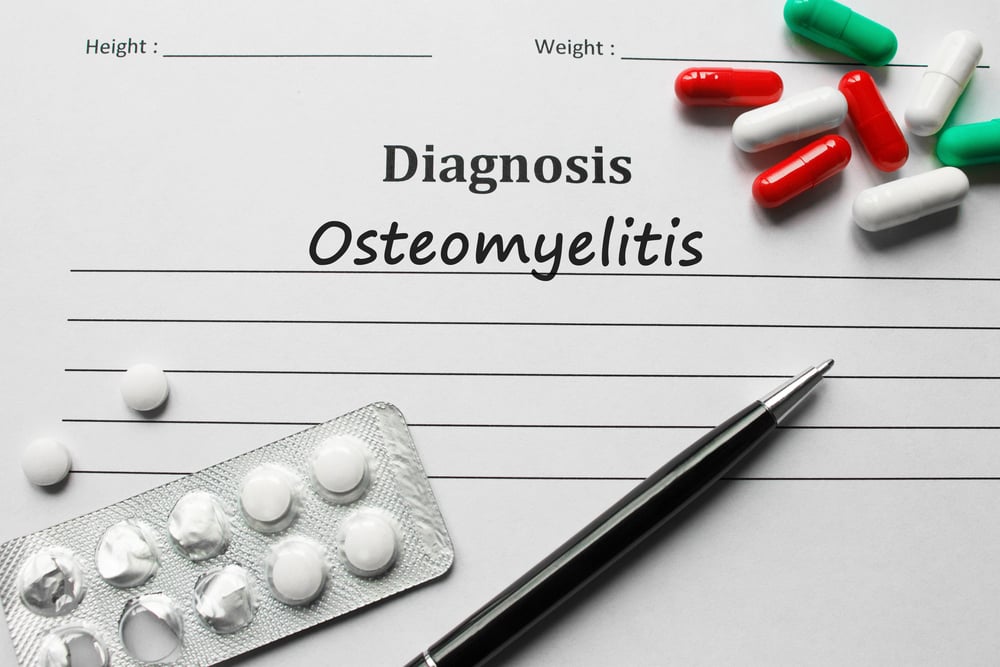 Recognizing the 10 Key Symptoms of Osteomyelitis - Facty Health