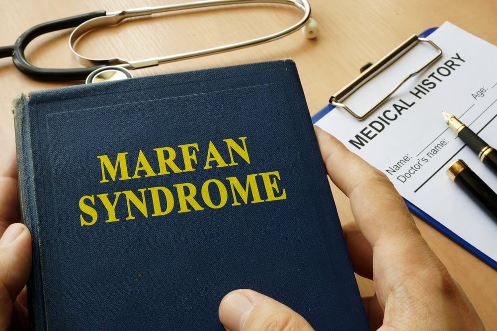 10 Essential Symptoms of Marfan Syndrome - Facty Health