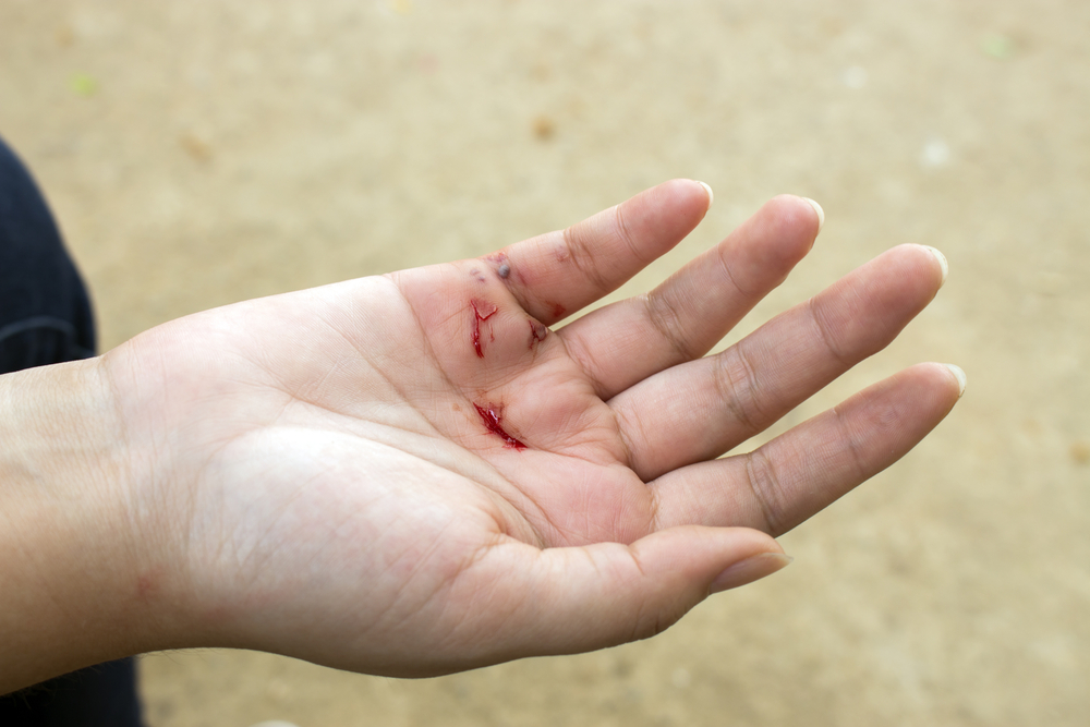 10 Symptoms Of Tetanus Facty Health