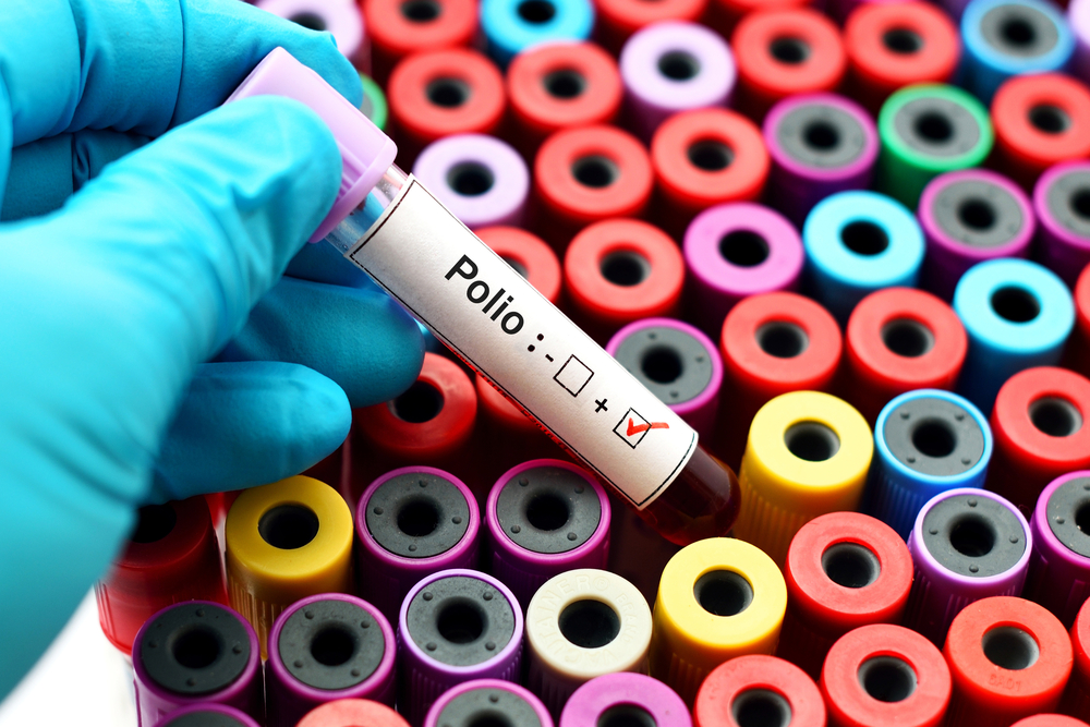 10 Symptoms of Polio - Facty Health