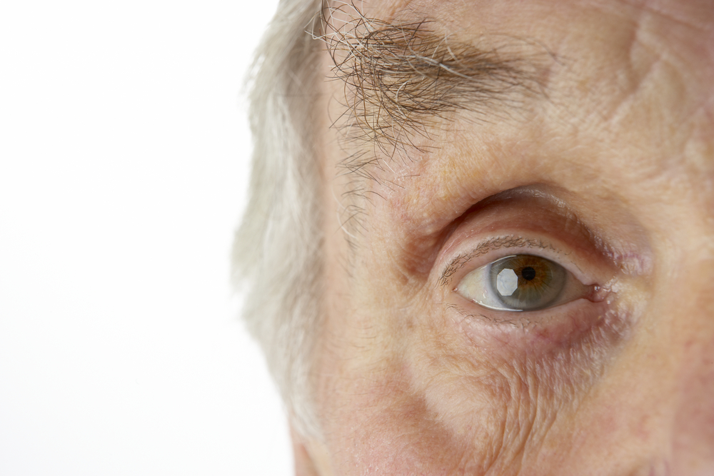 10 Signs Of Cataracts Facty Health 10 Signs Of Cataracts Facty Health
