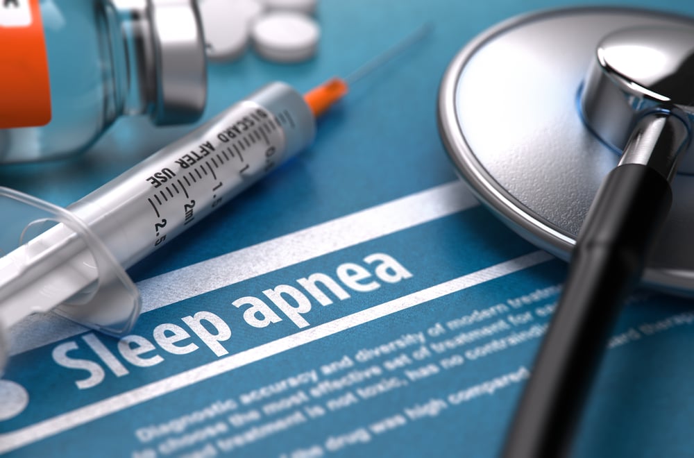 Understanding Obstructive Sleep Apnea: 10 Key Signs and Treatments ...