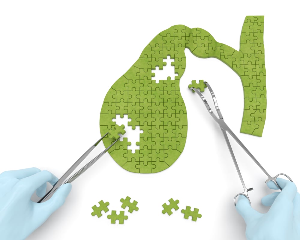 Healthy Gallbladder Guide - 10 Essential Tips - Facty Health