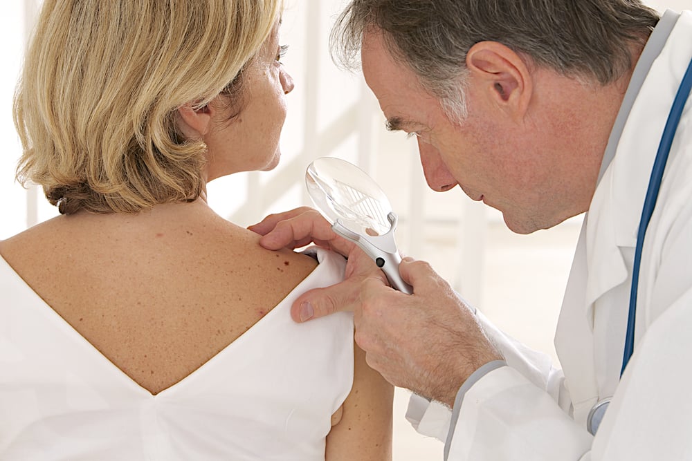 Symptoms and Treatments of Actinic Keratosis: A Detailed Overview ...