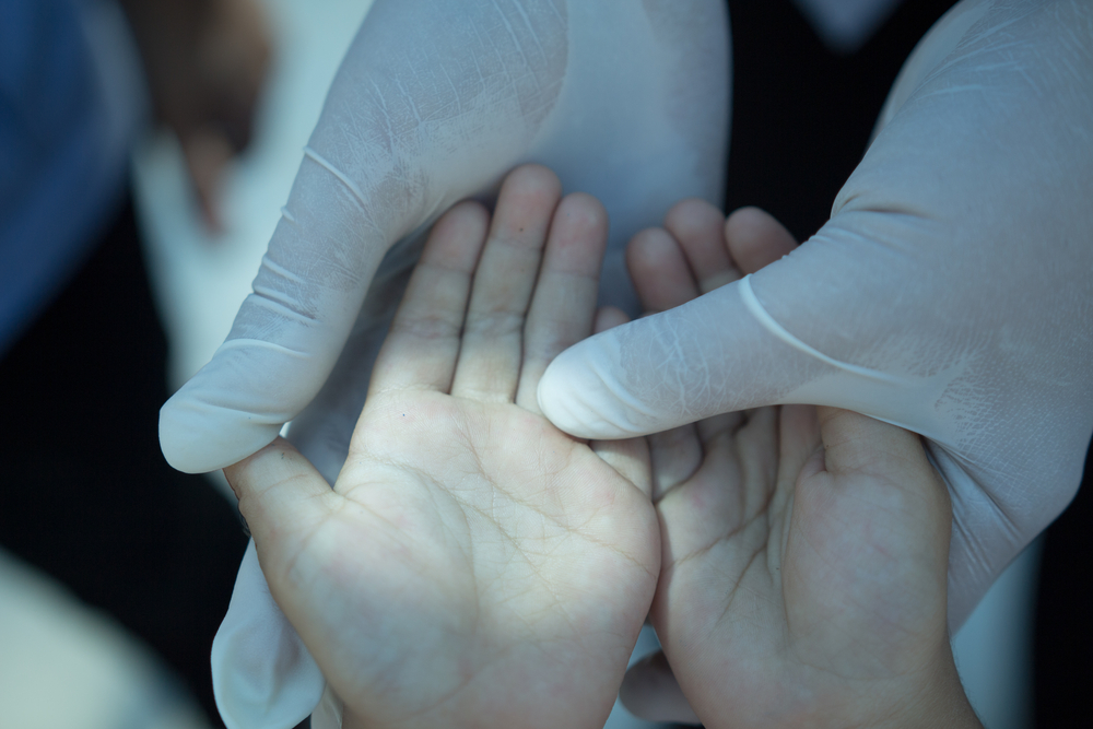 10 Symptoms and Treatments of Chilblains - Facty Health